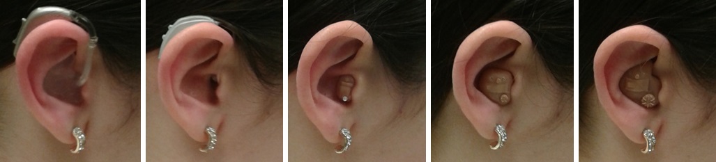 Audiology - Horizon Health Network