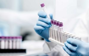 Blood and Specimen Collection - Horizon Health Network