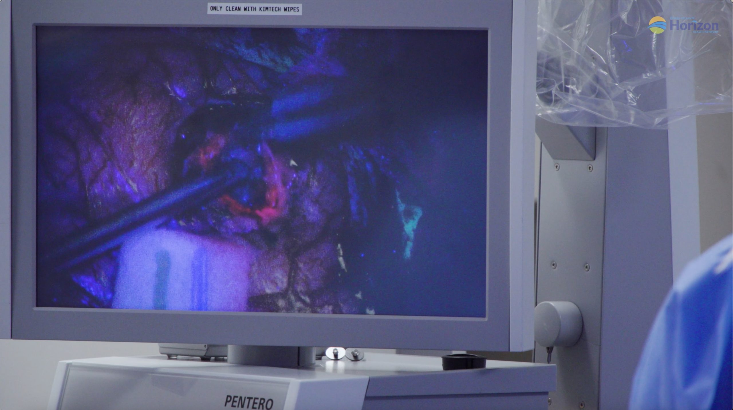 Innovative product lighting the way for Horizon neurosurgeons, brain ...